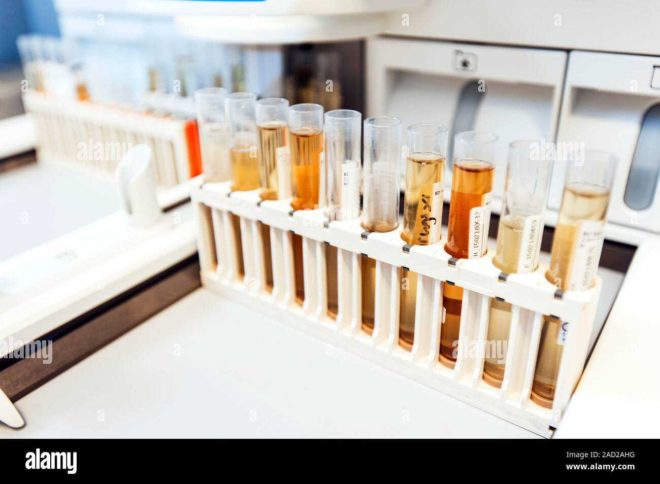 Urology laboratory. Urine samples being prepared for analysis in tubes ...