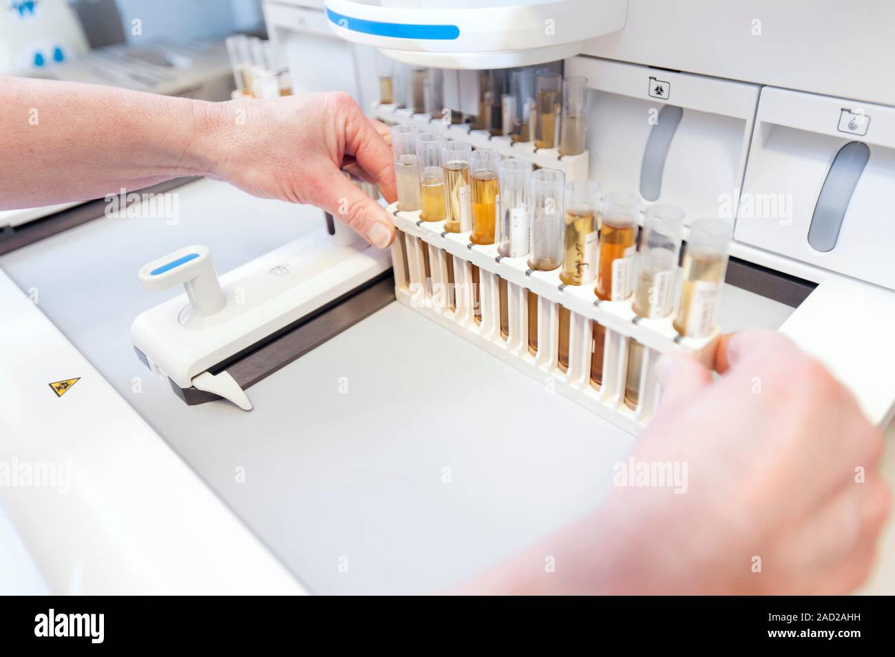 Urology laboratory. Urine samples being prepared for analysis in tubes ...
