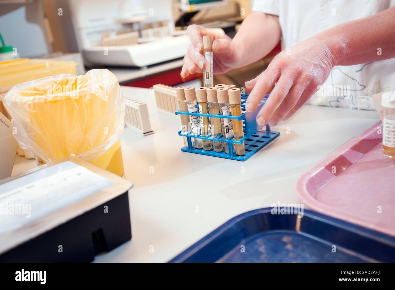 Urology laboratory. Urine samples being prepared for analysis in tubes ...