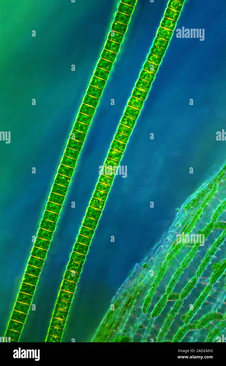 Desmids on sphagnum moss. Darkfield illuminated polarised light ...