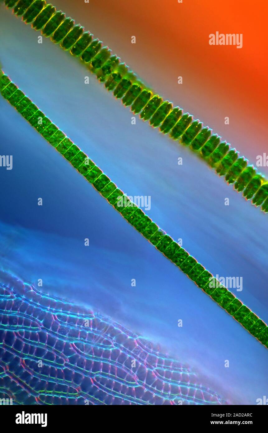 Desmids on sphagnum moss. Darkfield illuminated polarised light ...