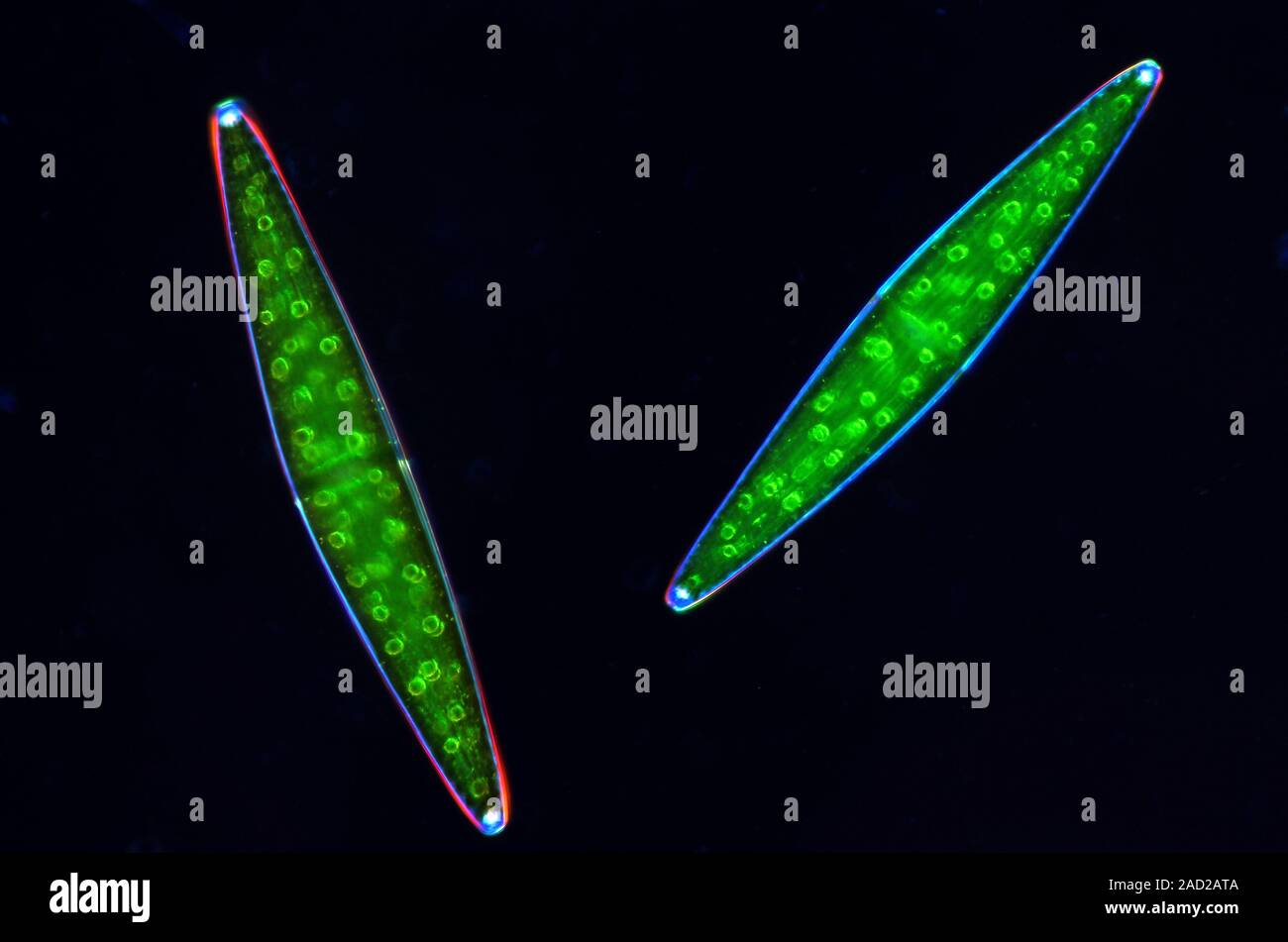 Closterium desmids. Darkfield illuminated polarised light micrograph of ...