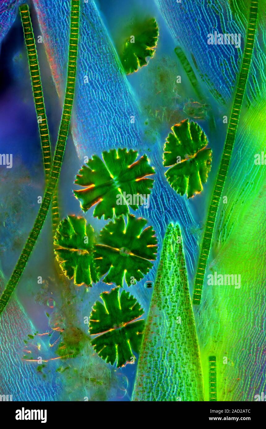 Desmids on sphagnum moss. Darkfield illuminated polarised light ...