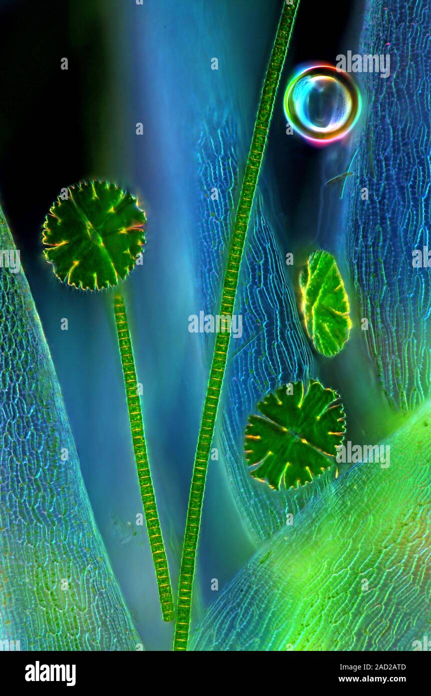 Desmids on sphagnum moss. Darkfield illuminated polarised light micrograph of Hyalotheca sp ...