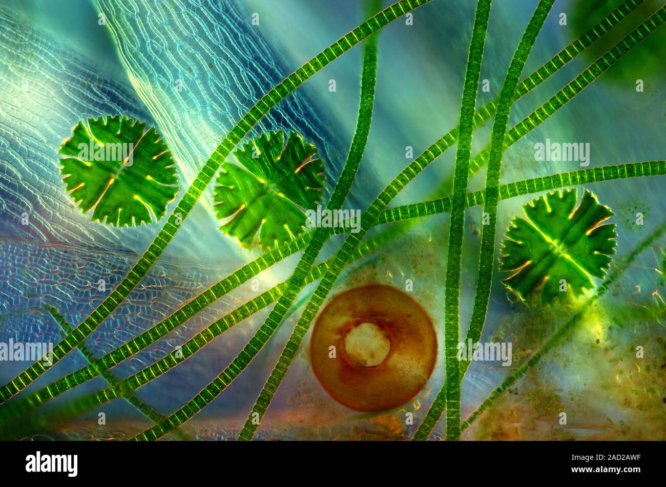 Desmids and shelled amoeba. Darkfield illuminated polarised light ...