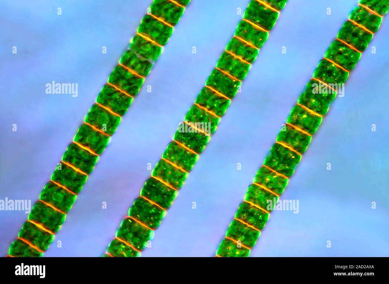 Hyalotheca desmids. Polarised light micrograph of Hyalotheca sp ...