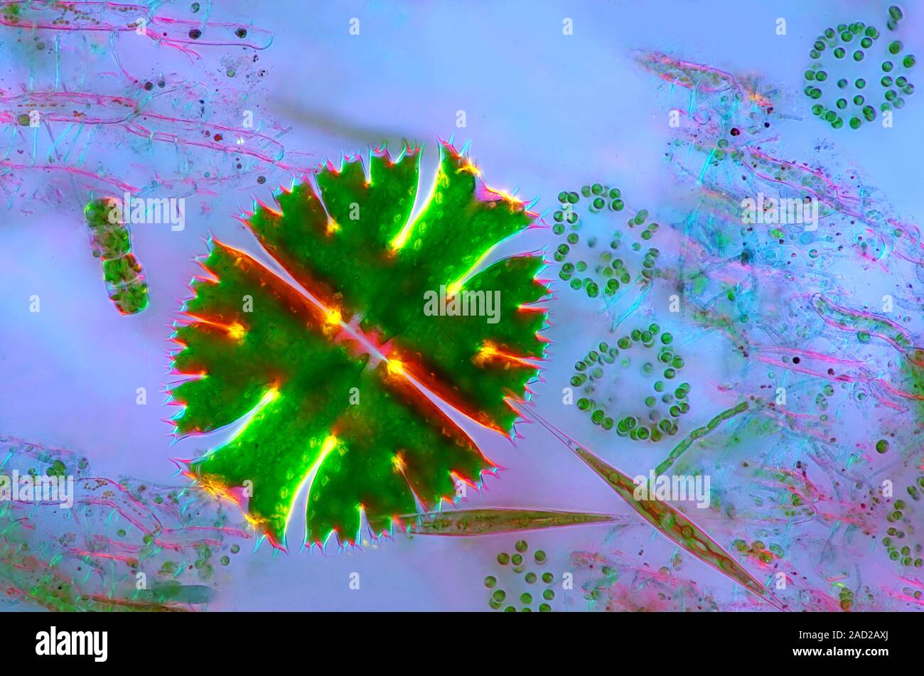Desmid and Dictyosphaerium green algae. Polarised light micrograph of a ...