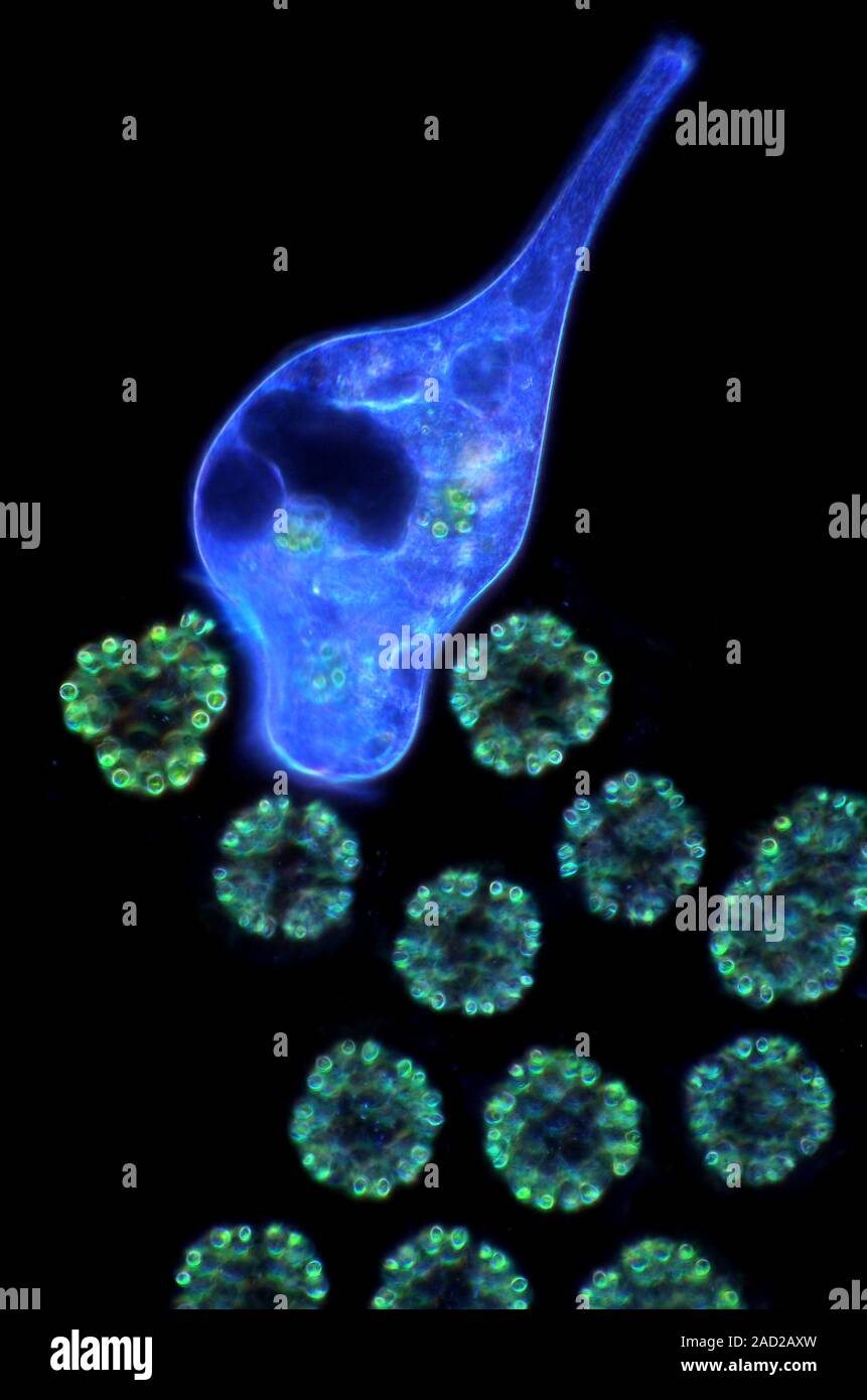 Protozoan and Dictyosphaerium green algae. Darkfield illuminated ...