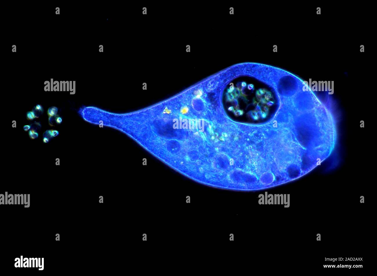 Protozoan and Dictyosphaerium green algae. Darkfield illuminated ...