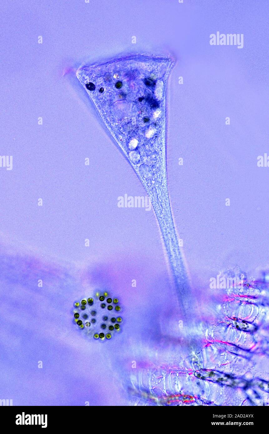 Stentor protozoan. Polarised light micrograph of a section through a ...