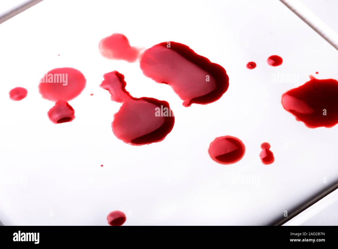 Blood spatter. In forensic science, the pattern created by projected ...