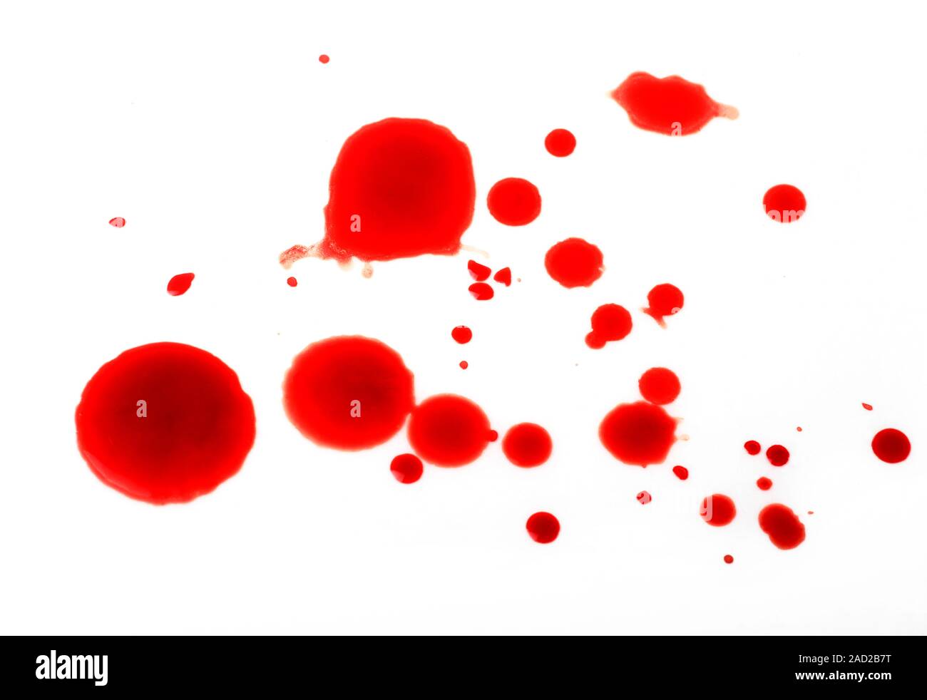 Blood spatter. In forensic science, the pattern created by projected ...