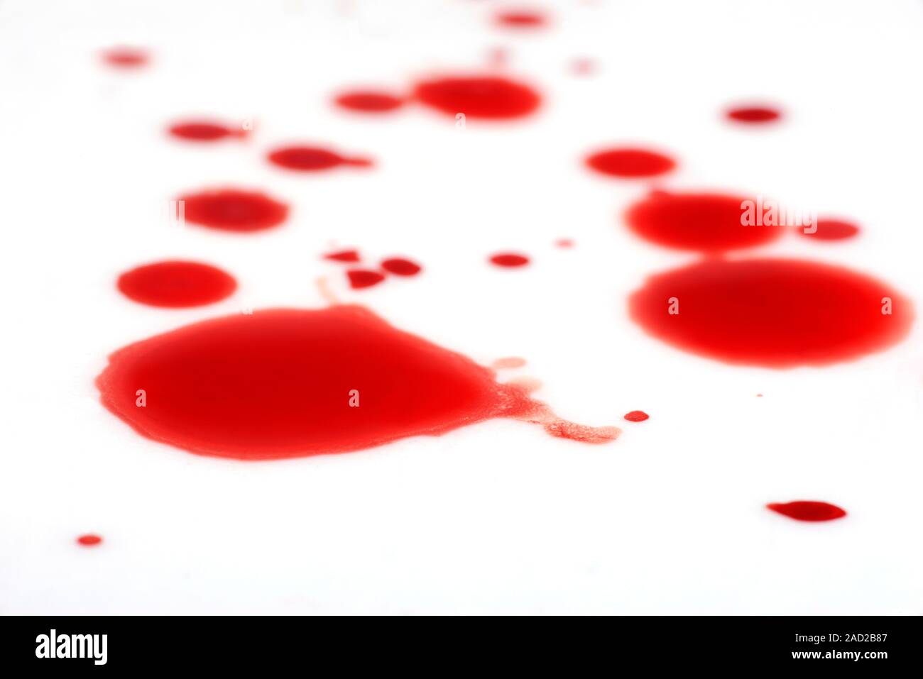Blood spatter. In forensic science, the pattern created by projected ...
