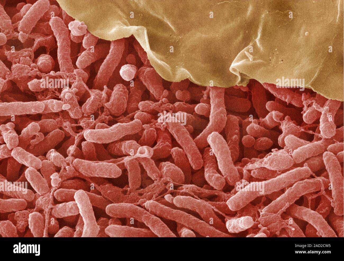 Coloured scanning electron micrograph (SEM) of Rhizobium leguminosarum ...