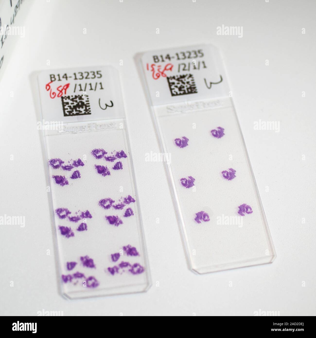 gastrointestinal biopsy slides. Slides prepared with stained tissue ...