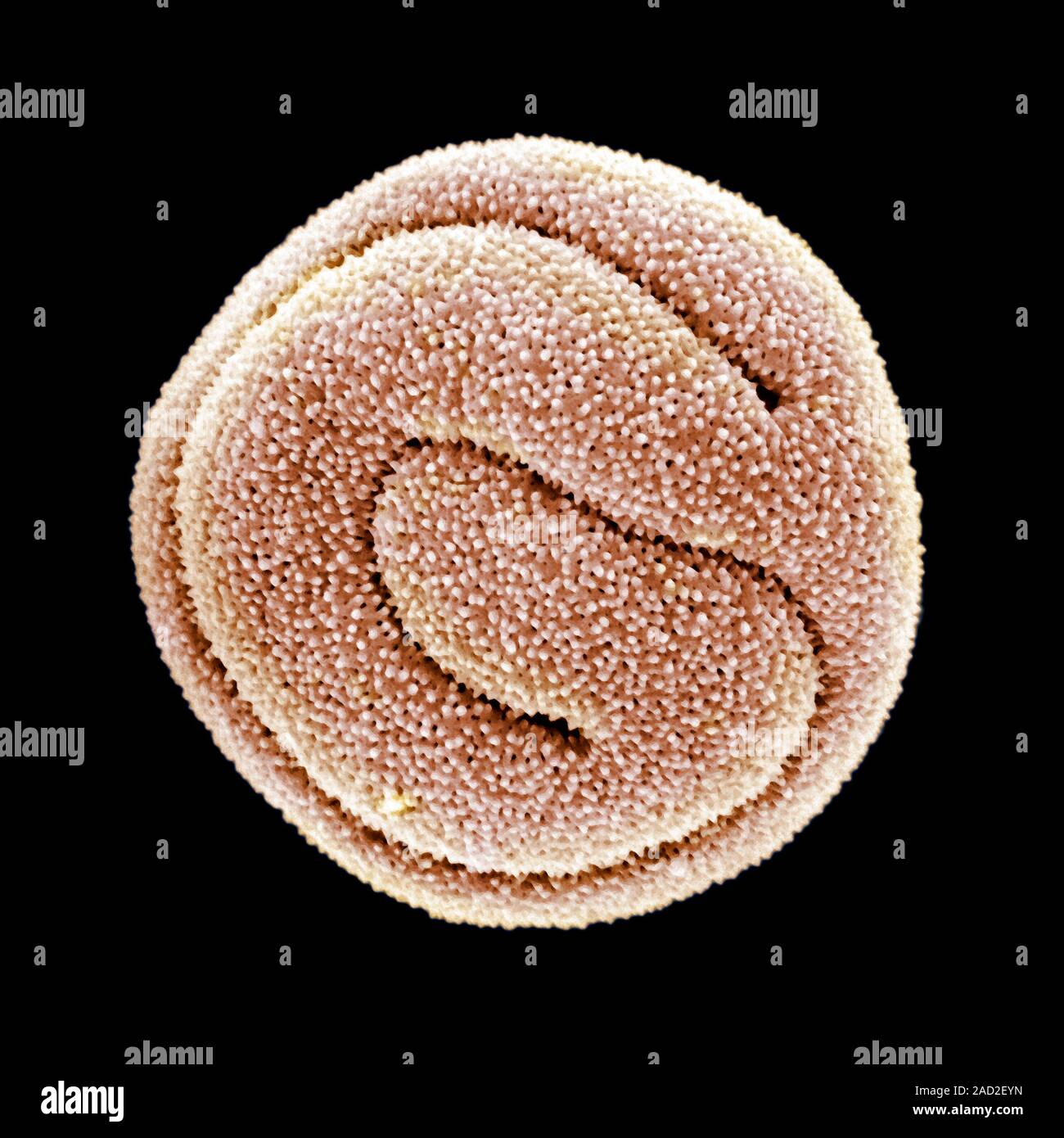 Scanning Electron Microscope Image of a pollen grain (colourised Stock ...