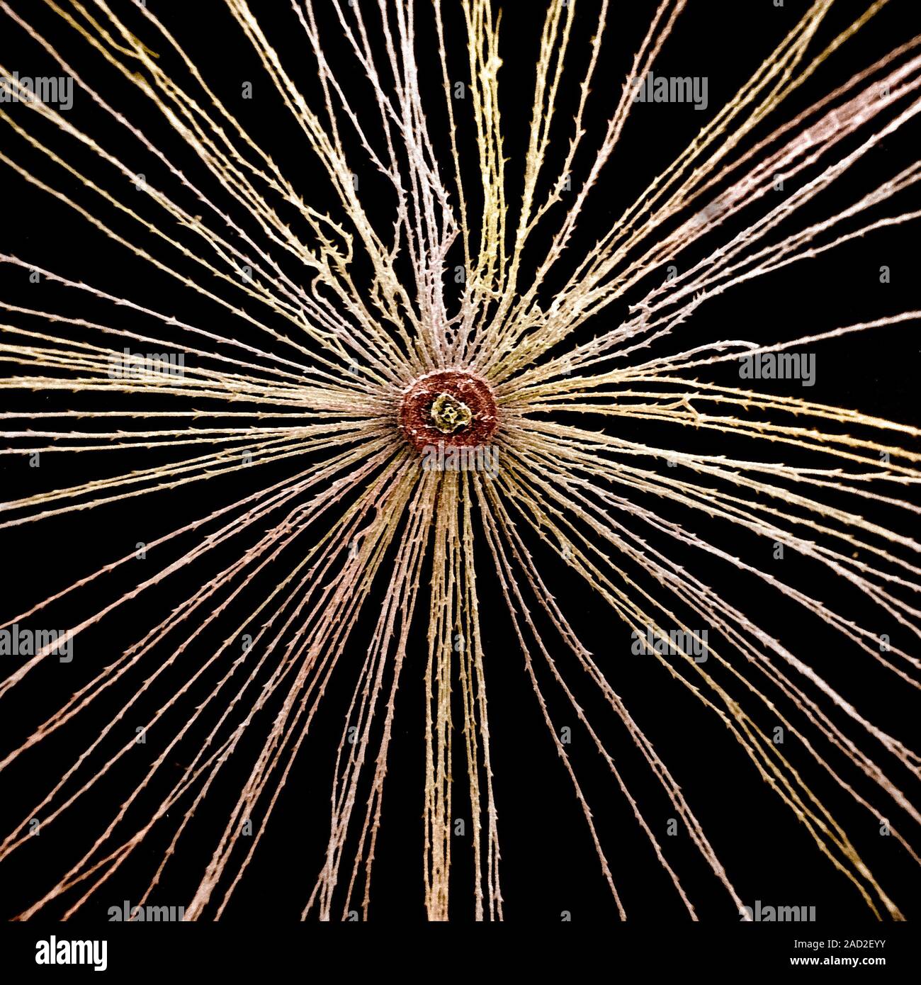 Scanning Electron Microscope Image of a dandelion (Taraxacum sp.) seed ...
