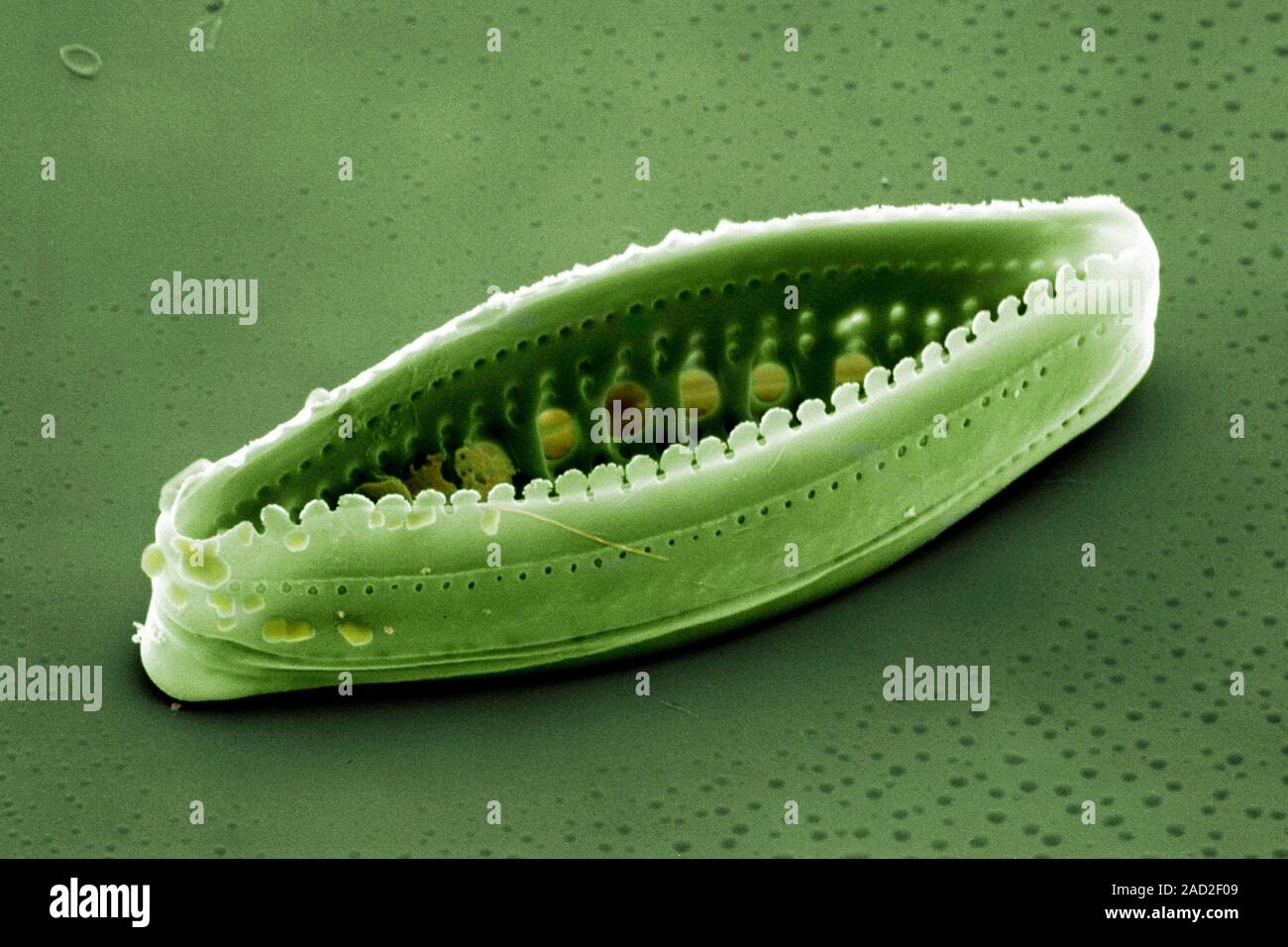 Scanning Electron Microscope Image of a diatom (colourised Stock Photo ...
