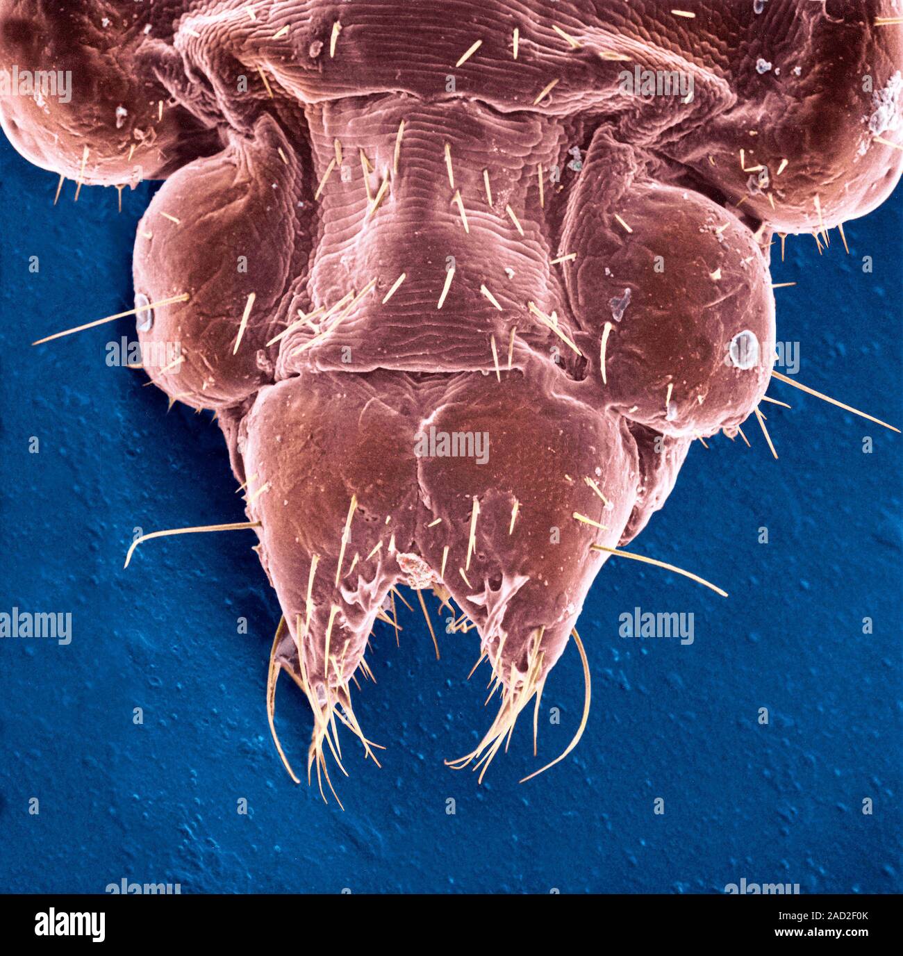 Scanning Electron Microscope Image of a head louse, Pediculus humanus ...