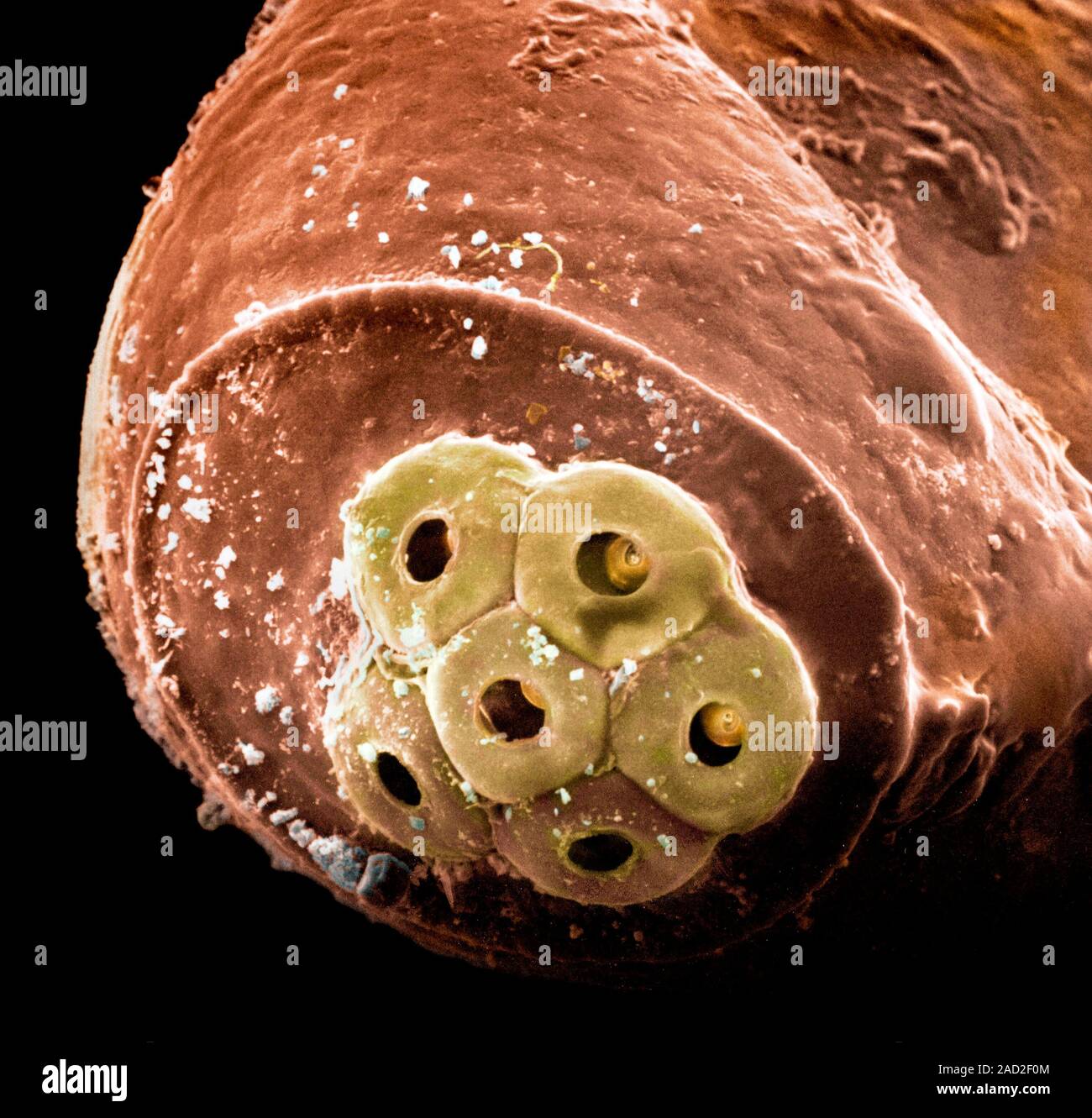 Scanning Electron Microscope Image of a head louse, Pediculus humanus ...