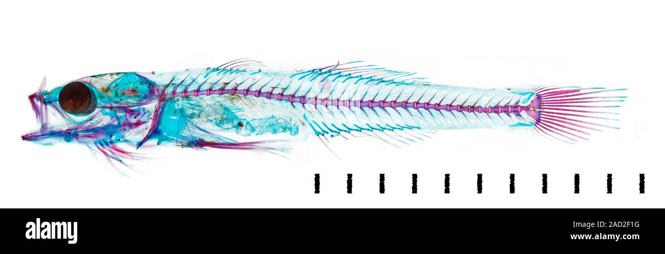 Juvenile goby (Pomatoschistus sp.). Fish specimen 'cleared and stained ...
