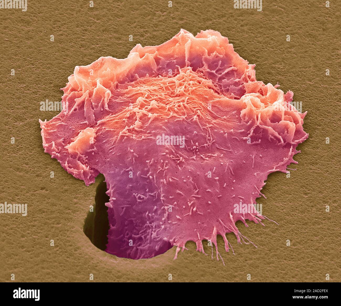 Migrating cancer cell. Coloured scanning electron micrograph (SEM) of a ...