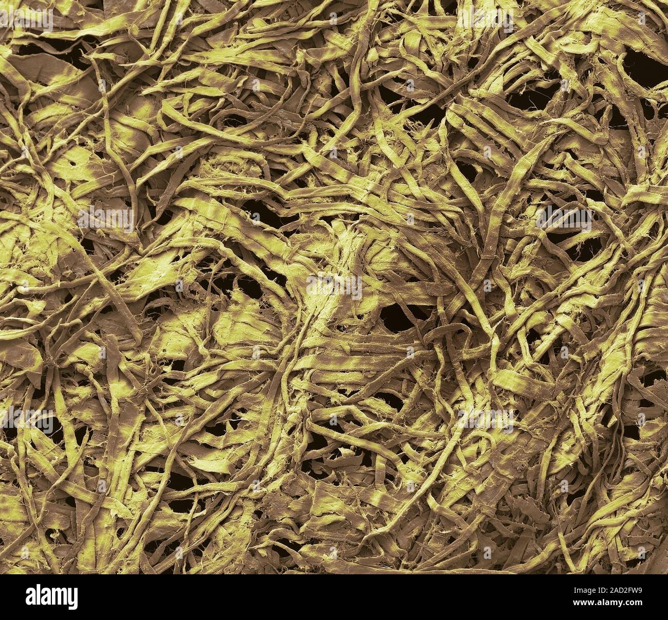 Eco tissue. Coloured scanning electron micrograph (SEM) of Eco tissue ...