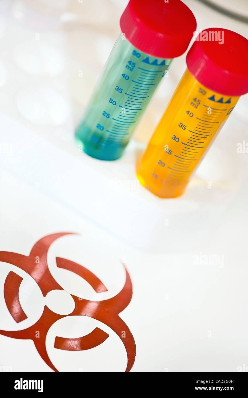 Biohazard symbol and sample analysis containers. The international ...