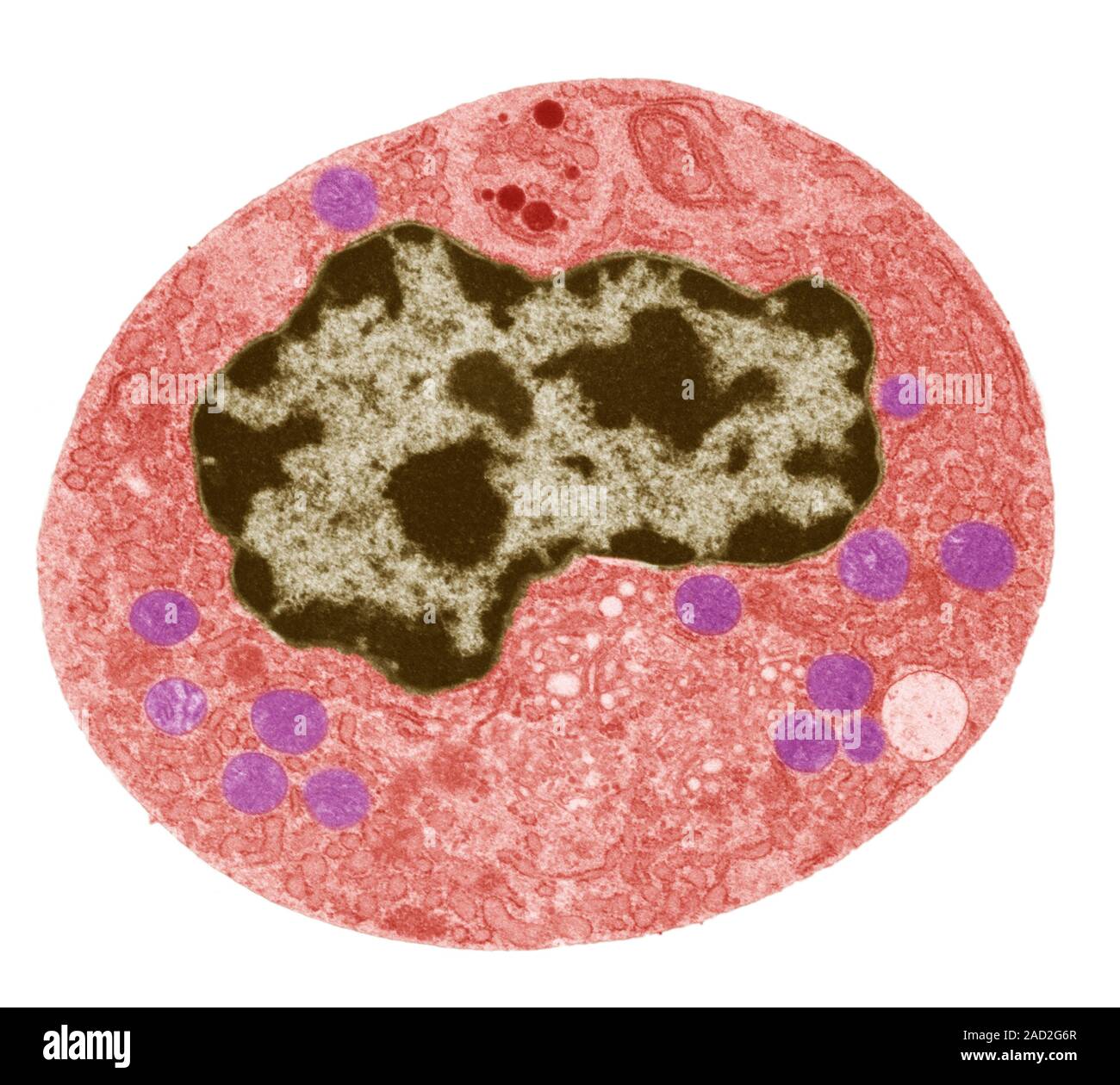 Thyroid cancer cell. Coloured transmission electron micrograph (TEM) of ...