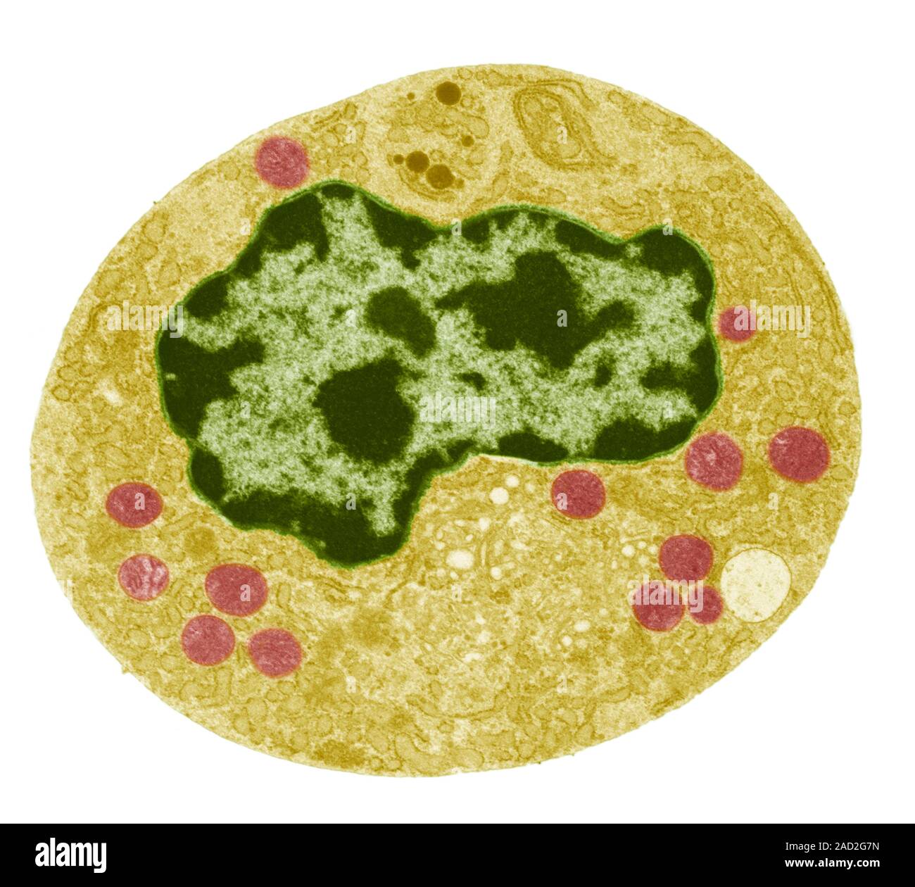 Thyroid cancer cell. Coloured transmission electron micrograph (TEM) of ...