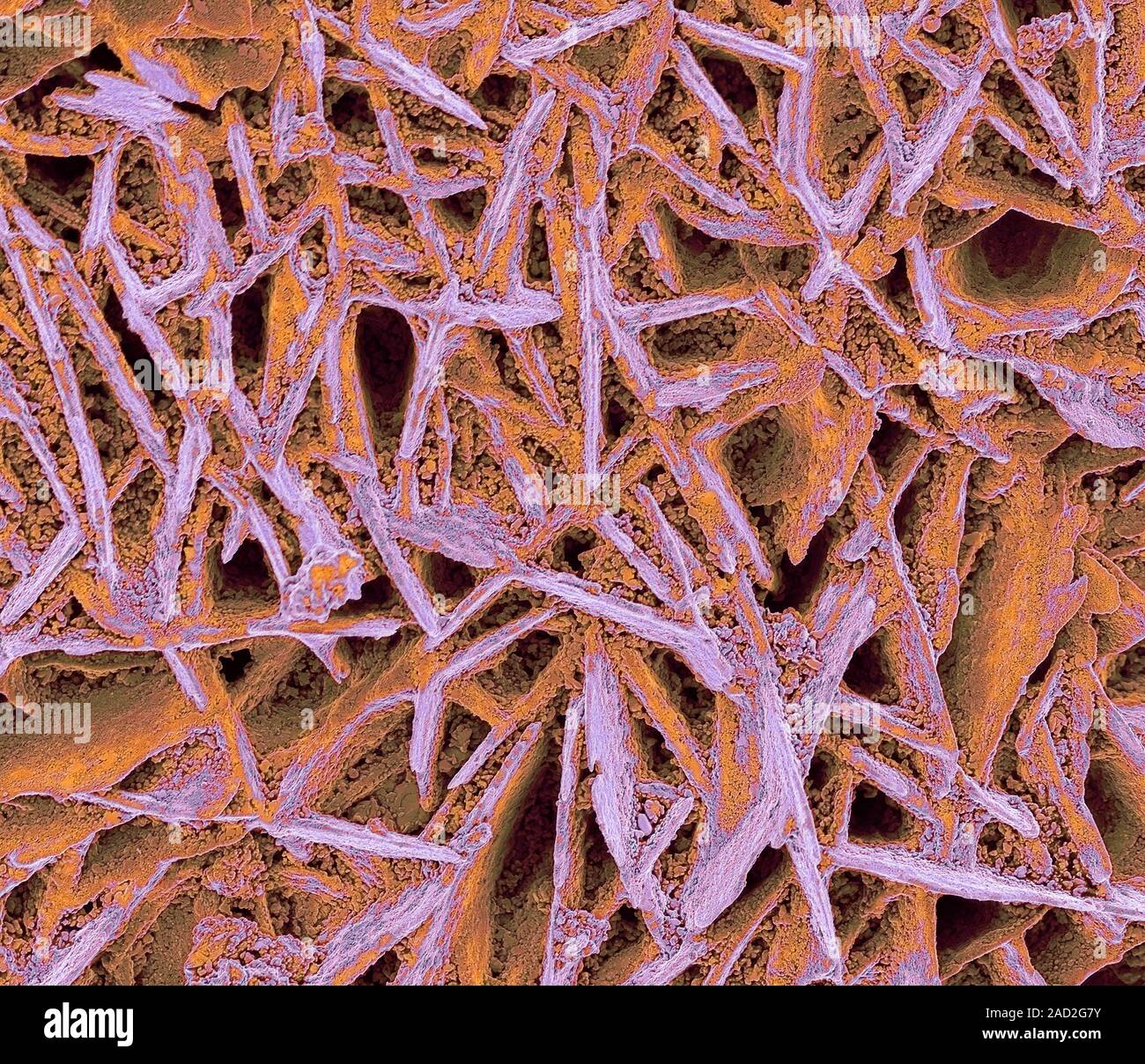 Rust. Coloured scanning electron micrograph (SEM) of rust on an iron ...