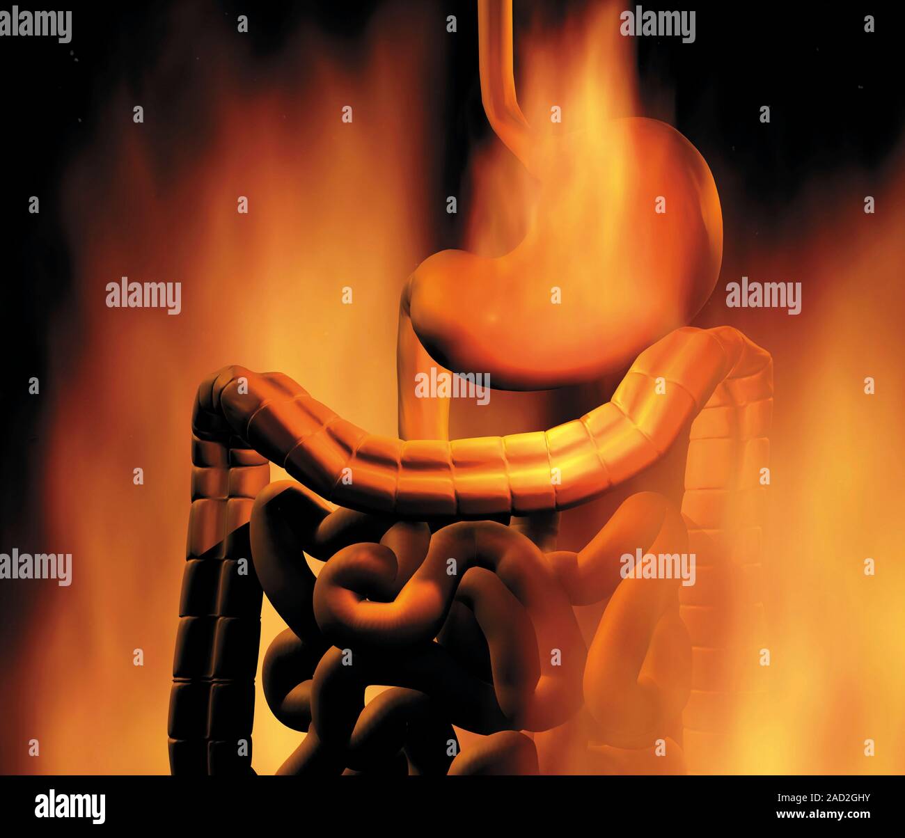 Bowel pain, conceptual computer illustration Stock Photo - Alamy