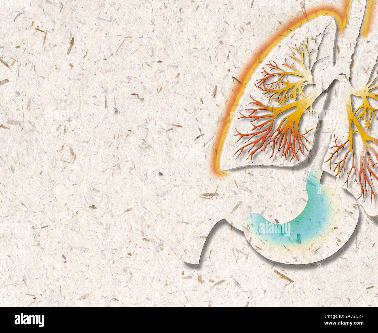 Lung inflammation, conceptual image. Computer illustration representing ...