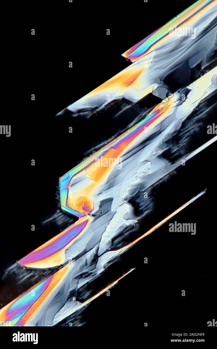 Urea crystals, polarised light micrograph. Uric acid (urea) is an end ...