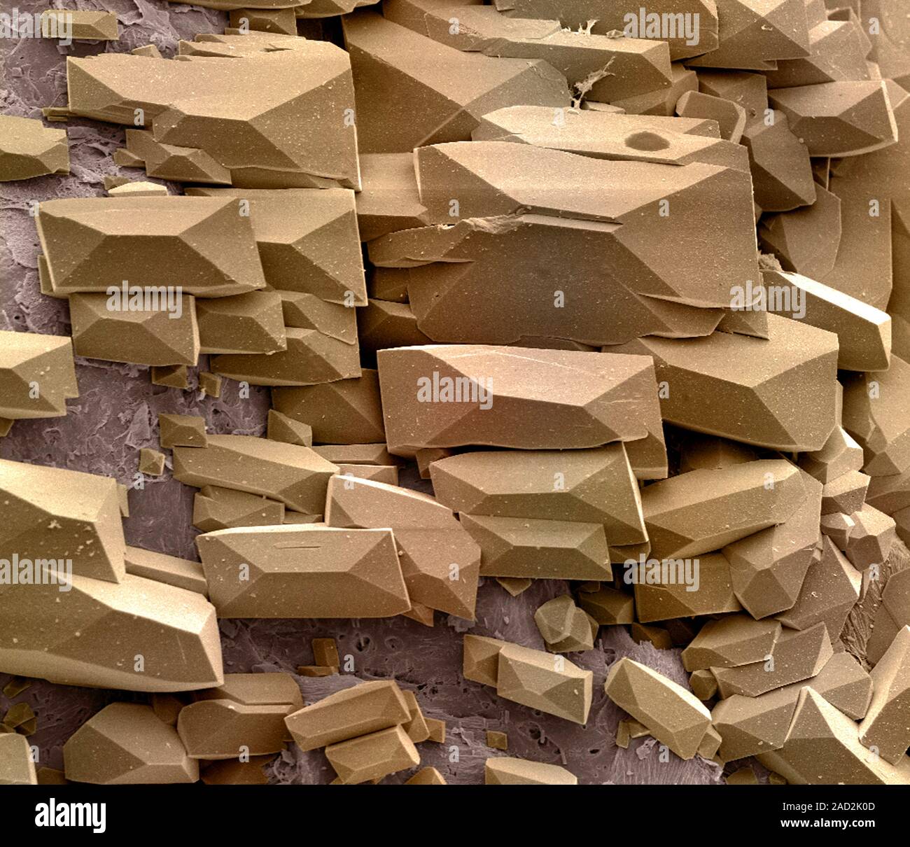 Sugar crystals. Coloured scanning electron micrograph (SEM) of sucrose ...