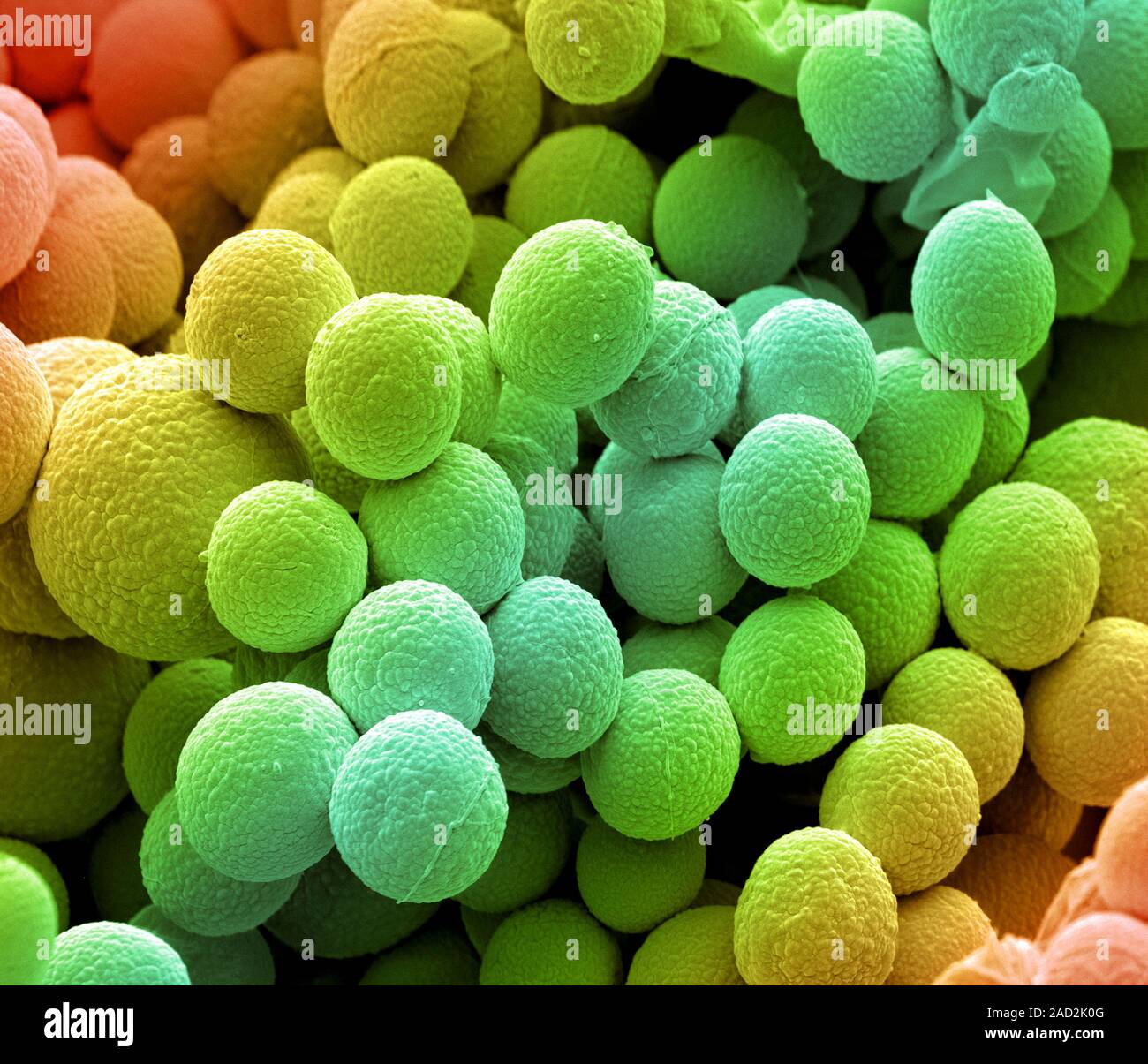 Bread mould conidia, coloured scanning electron micrograph (SEM). The ...