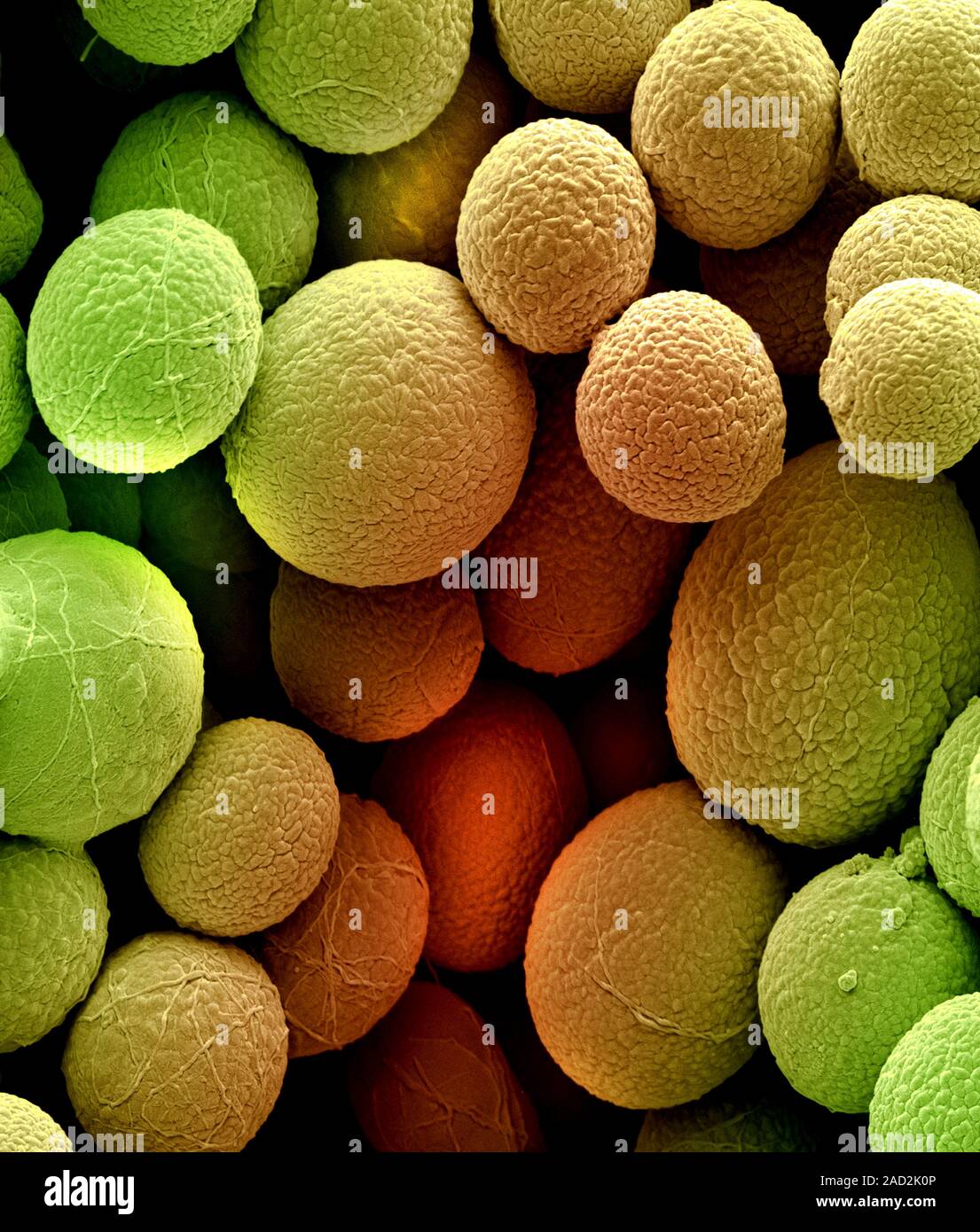 Bread mould conidia, coloured scanning electron micrograph (SEM). The ...