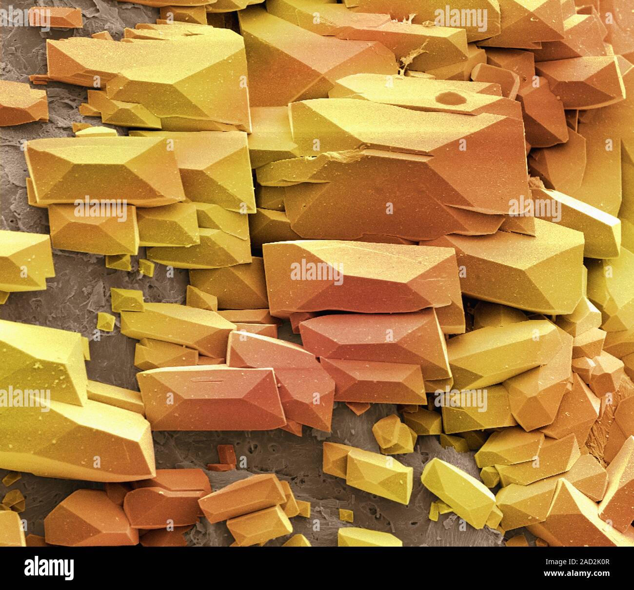 Sugar crystals. Coloured scanning electron micrograph (SEM) of sucrose ...