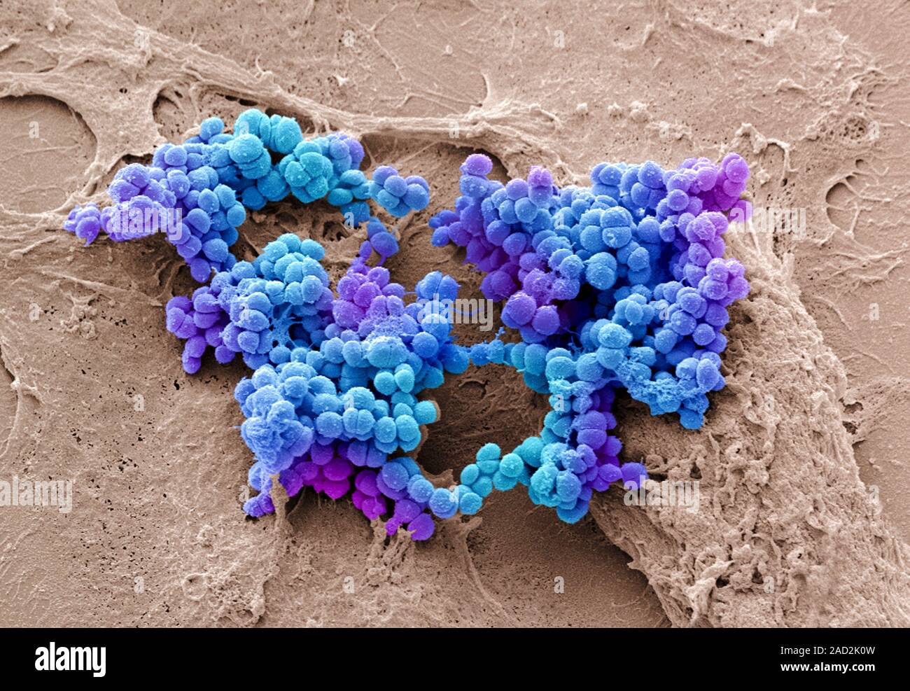 Staphylococcus aureus. Coloured scanning electron micrograph (SEM) of ... Staphylococcus aureus. Coloured scanning electron micrograph (SEM) of ...