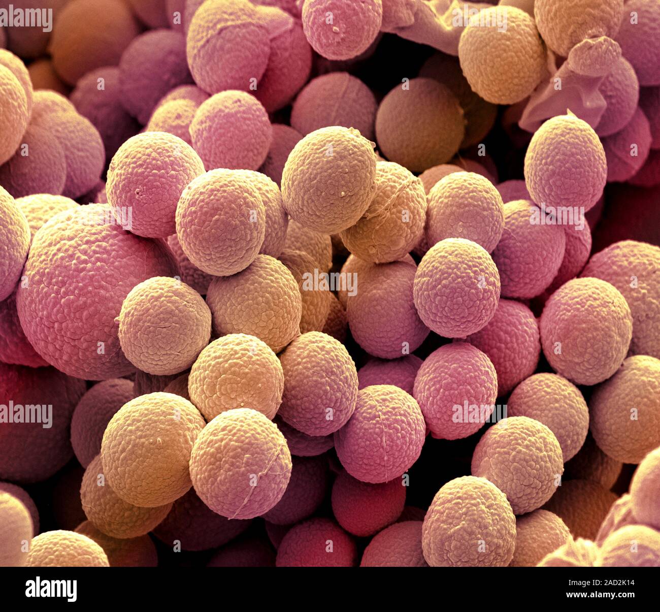 Bread mould conidia, coloured scanning electron micrograph (SEM). The ...