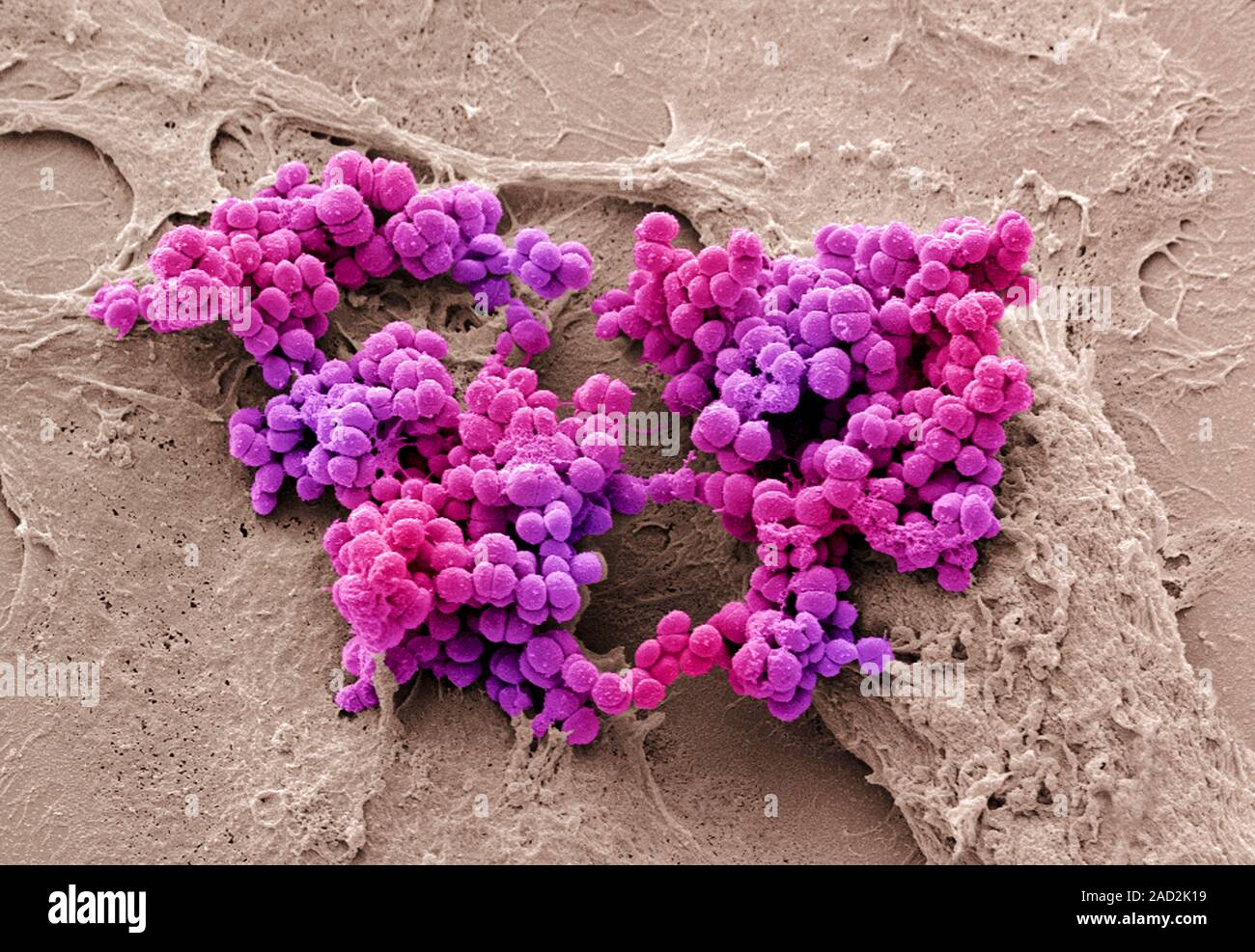 Staphylococcus aureus. Coloured scanning electron micrograph (SEM) of ...
