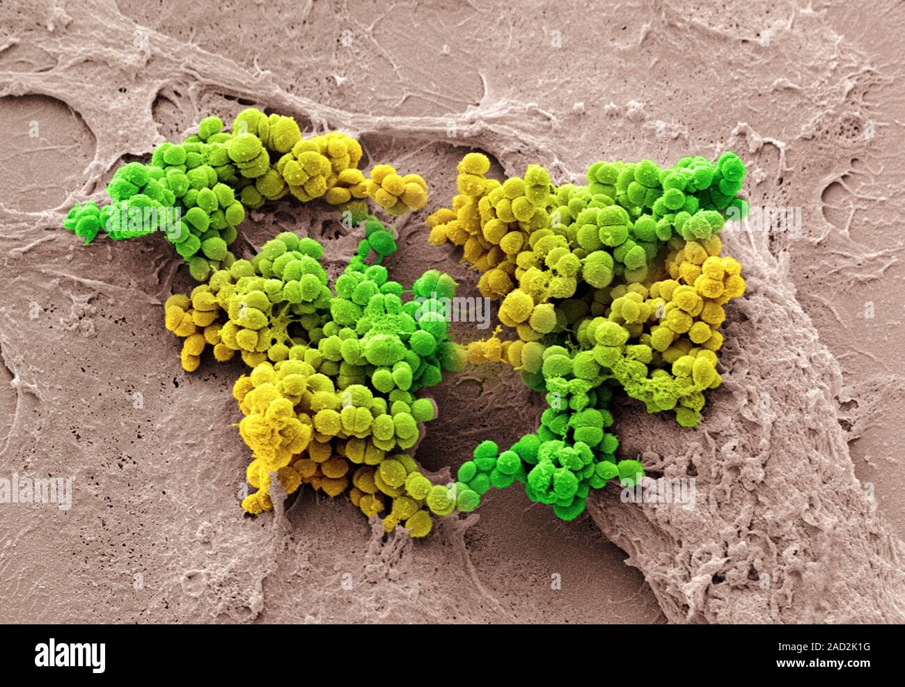 Staphylococcus aureus. Coloured scanning electron micrograph (SEM) of ...