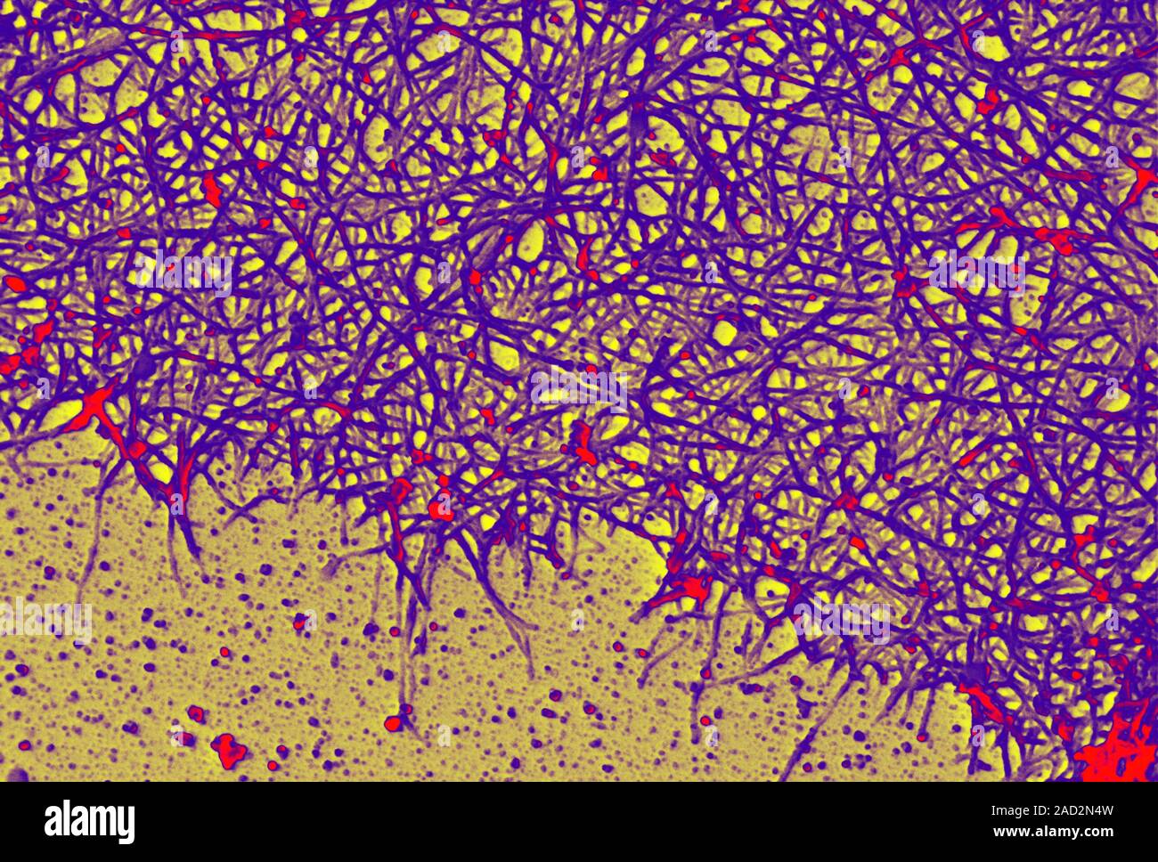 Coloued scanning electron micrograph (SEM) of a cell's cytoskeleton ...