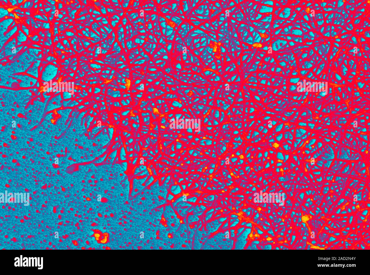 Coloued scanning electron micrograph (SEM) of a cell's cytoskeleton ...