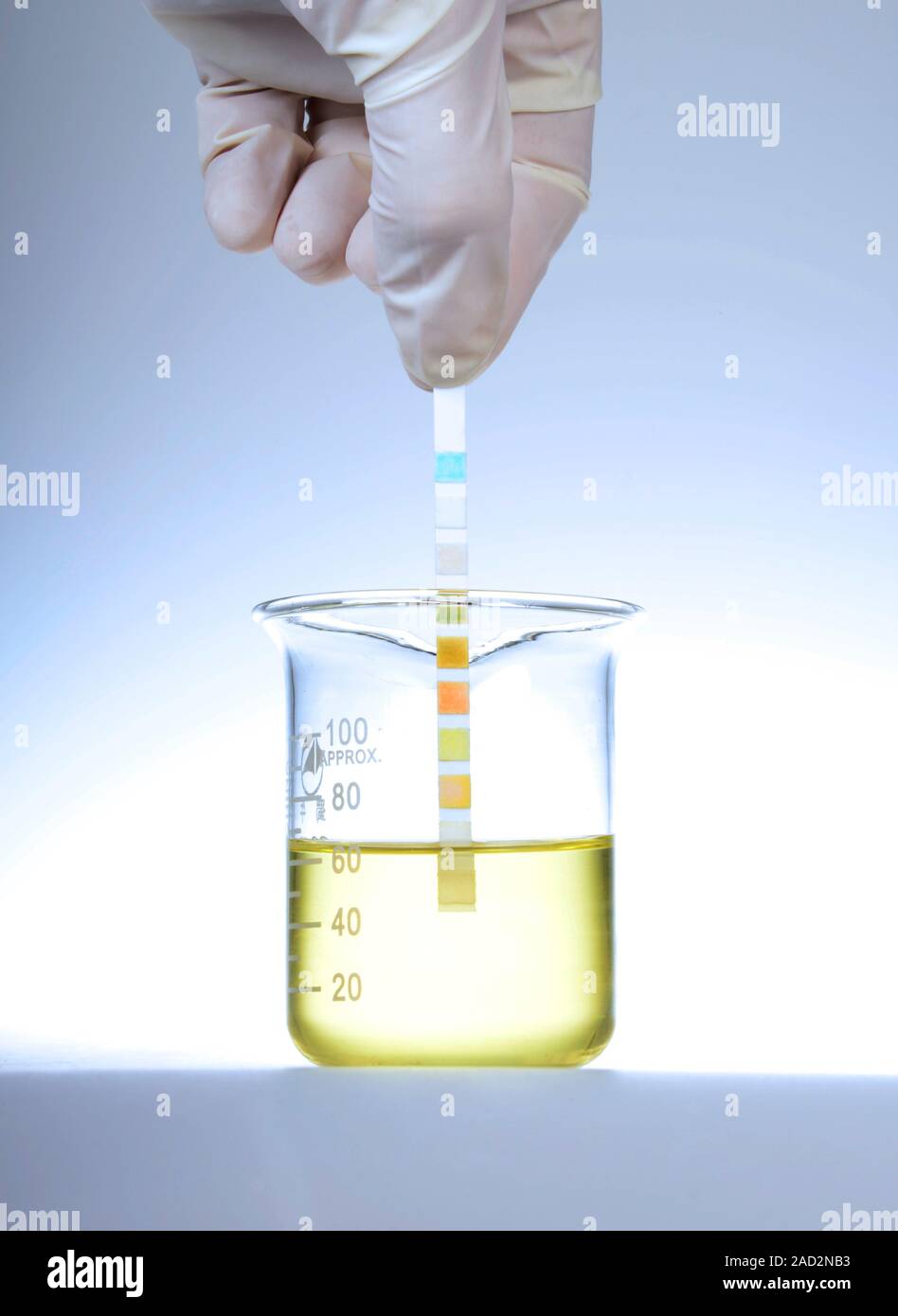 Home urine test. Home test kit for testing urine for signs of diabetes ...