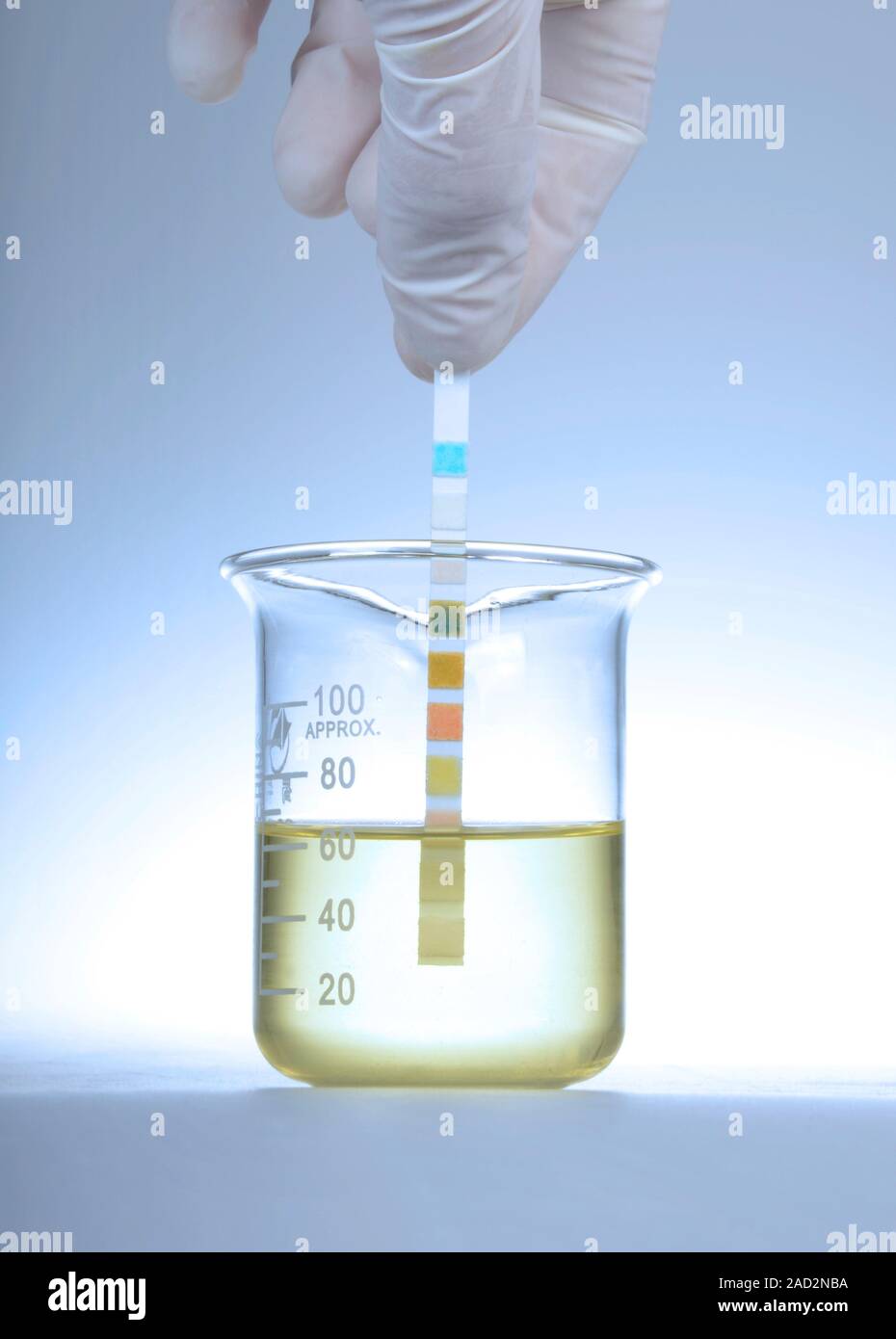 Home urine test. Home test kit for testing urine for signs of diabetes ...