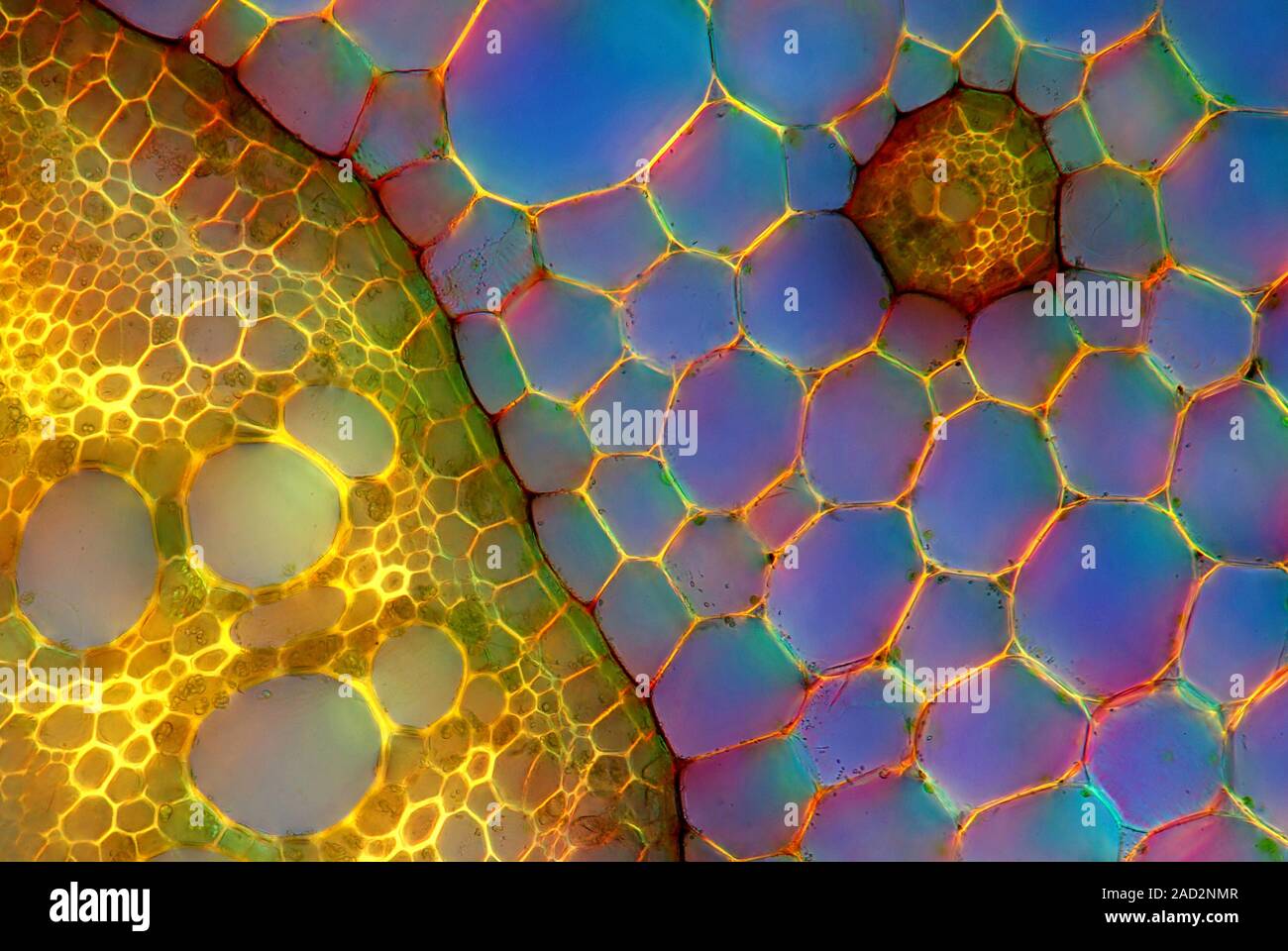 Fern stem. Polarised light micrograph of a section through the stem of ...
