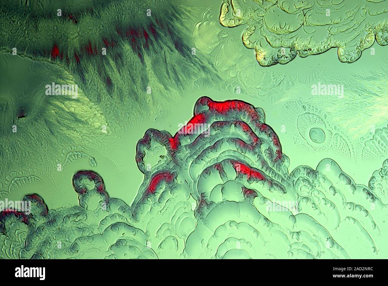 EDTA crystals. Polarised light micrograph of a section through ...