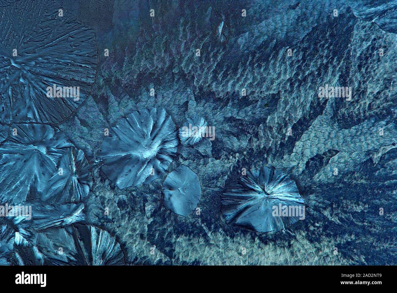 EDTA crystals. Polarised light micrograph of a section through ...