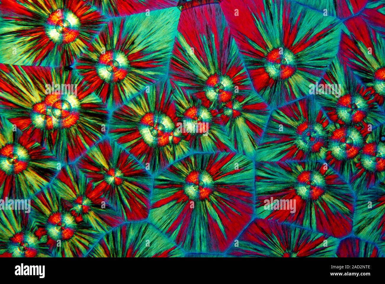 EDTA crystals. Polarised light micrograph of a section through ...
